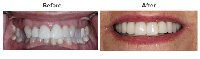Dr. Rick Martin's - Before & After Photos - Phoenix Dentist - Harris Dental
